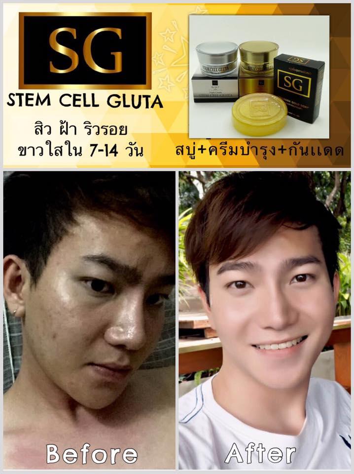 Stem Cell Gluta By Dr.t (ของแท้ 100% VIP)เซตหน้าขาวใส เซรั่ม +สบู่คอลลาเจนทองคำ+ครีมบำรุง 5 กรัม ...