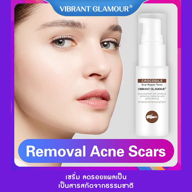 เจลลดแผลเป็น Z-scar skin care gel from USA แผลเป็นนูน จุดด่างดำ แผลไฟ ...