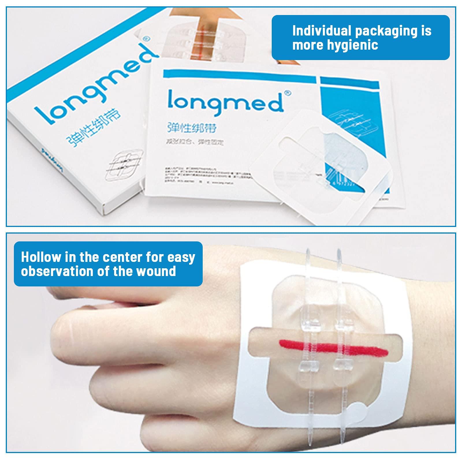 URIT 246 Pcs Zipper Band-aid Painless Wound Closure Device Suture-free ...