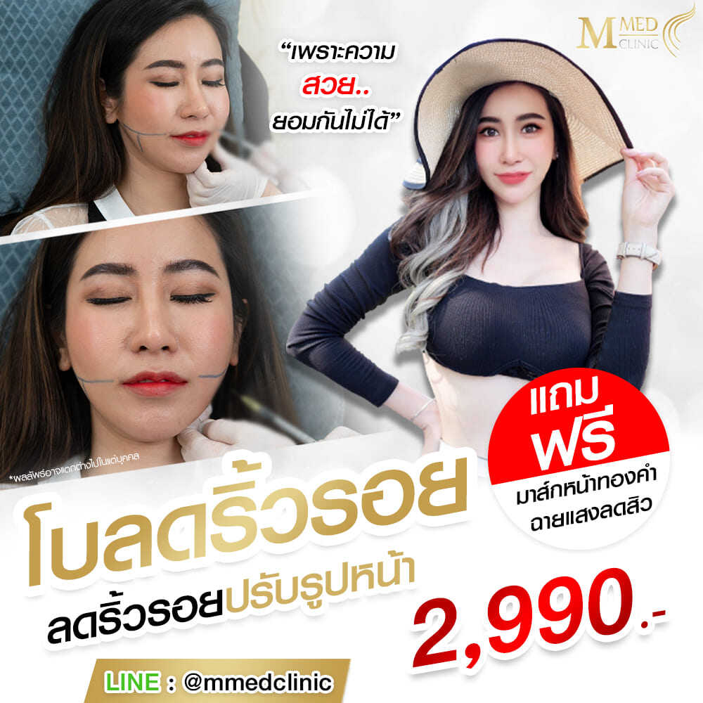 M Med Clinic [E-voucher] โบทอกซ์ Nabota หรือ Hugel 50U. เพียง 2,990.- | Lazada.co.th