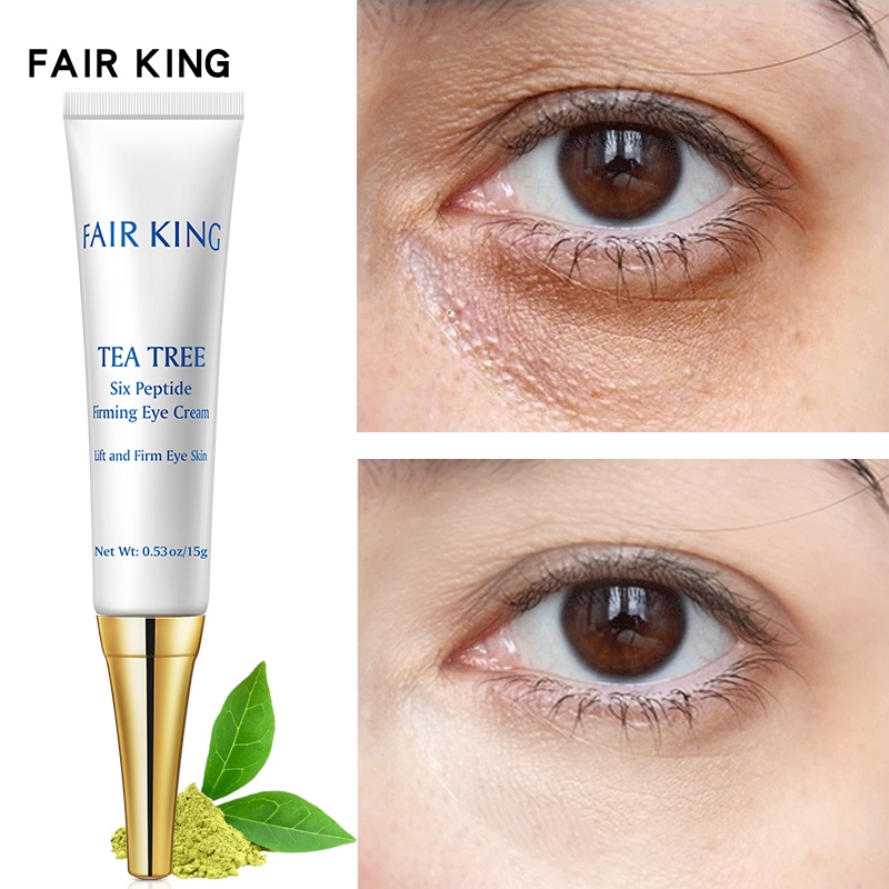 FAIR KING Anti Wrinkle Eye Cream Removes Dark Circles Eye Bags ...