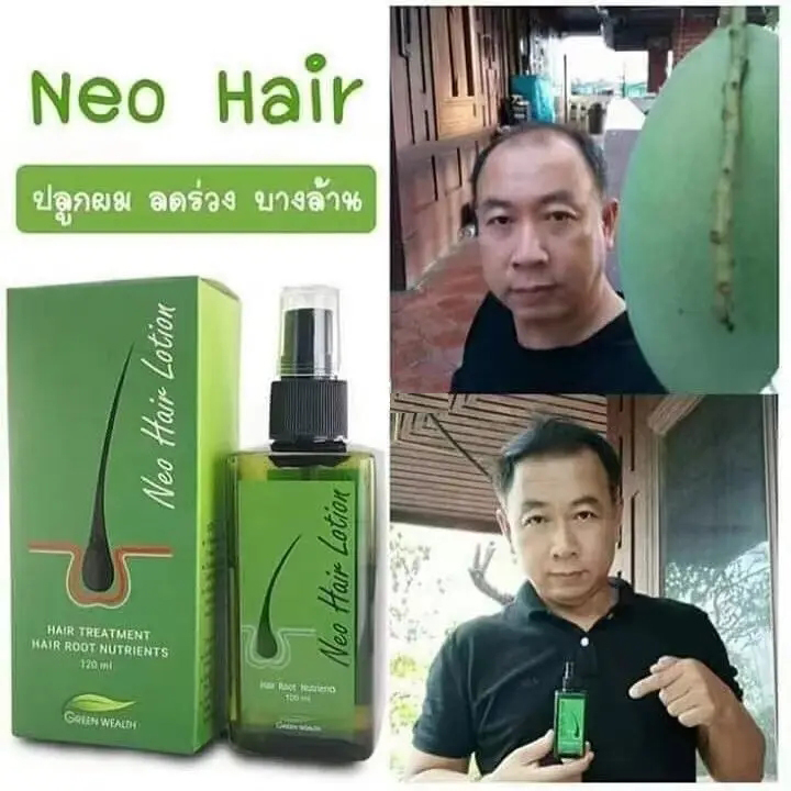 พร้อมส่ง100ของแท้ Neo Hair Lotion(NeoHair)สเปรย์ปลูกผมและบำรุงรากผม ...