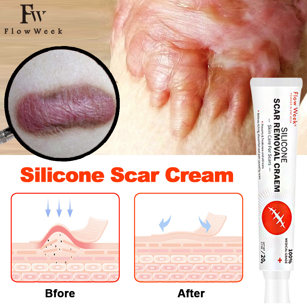 FlowWeek Scar Cream Sigh Scar Repair Scar Old Scar Blisters Bleeding ...