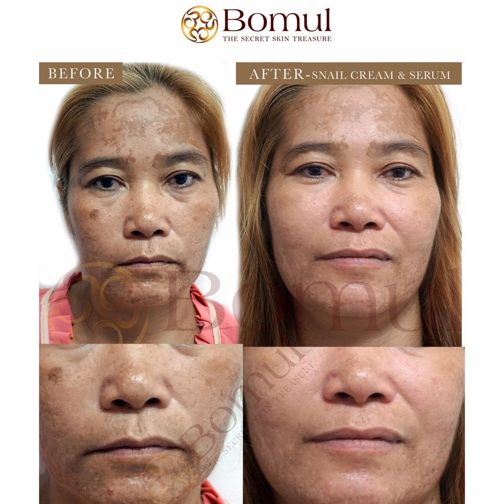 ใครยังไม่ลอง ถือว่าพลาดมาก !! **MADE IN KOREA** BOMUL Snail Cream ครีม ...