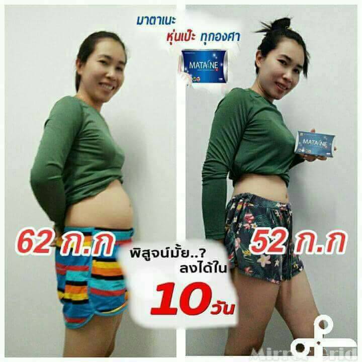 Matane มาตาเนะ 6 กล่องโปร 1450 ของแท้ 100 พร้อมส่ง - Labellashop - ThaiPick