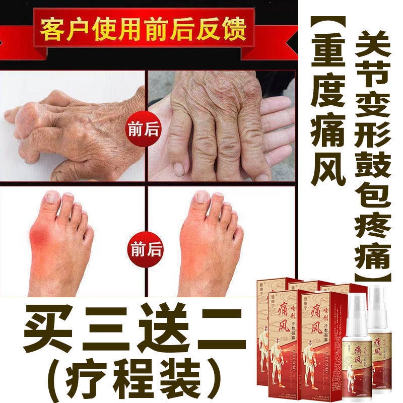 New Version Of Gout Special Effect Uric Acid High Finger Joint Pain ...