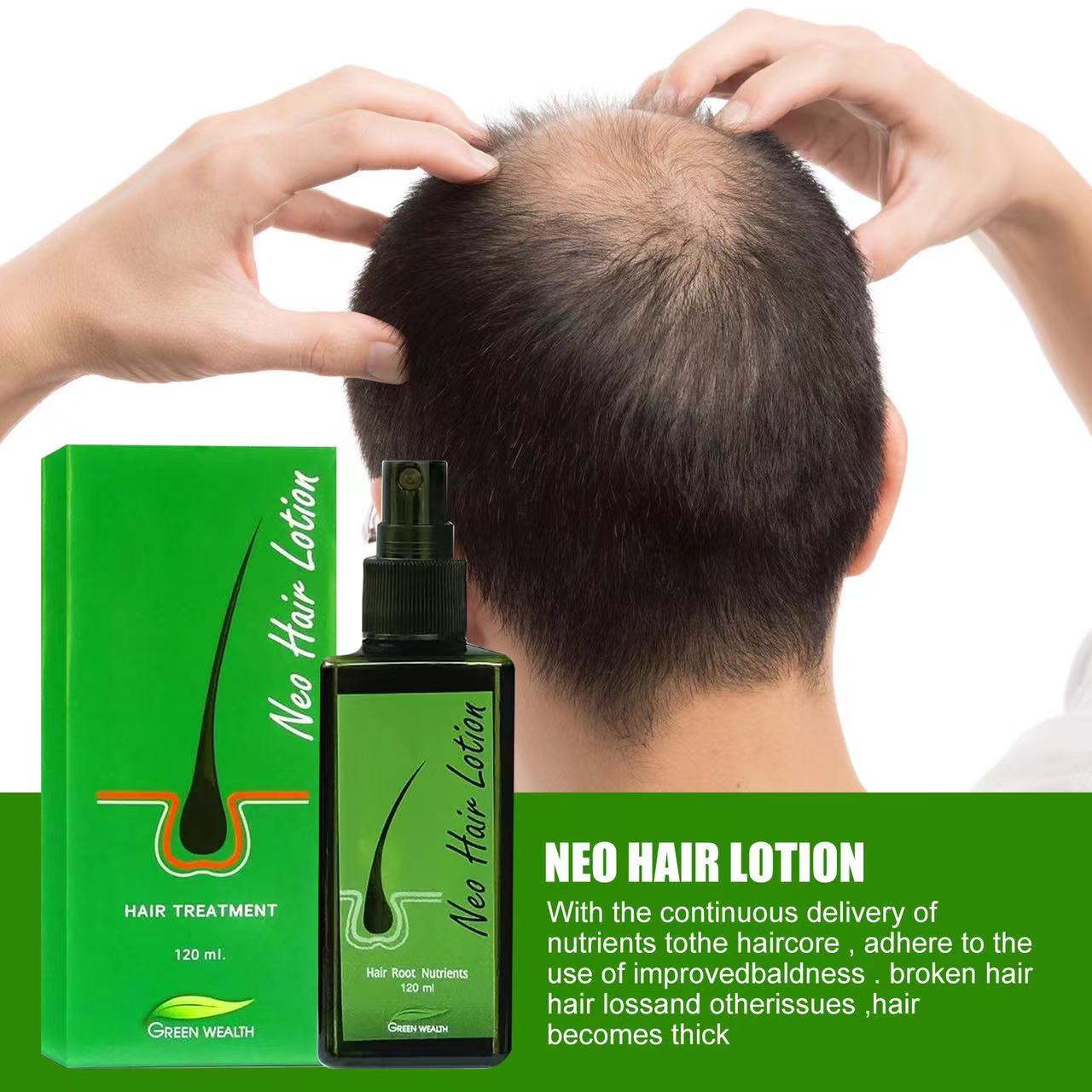 ของแท้ล๊อตล่าสุด ส่งด่วนLEX ผลิตภัณฑ์บำรุงเส้นผม แชมพู Neo Hair Lotion ...