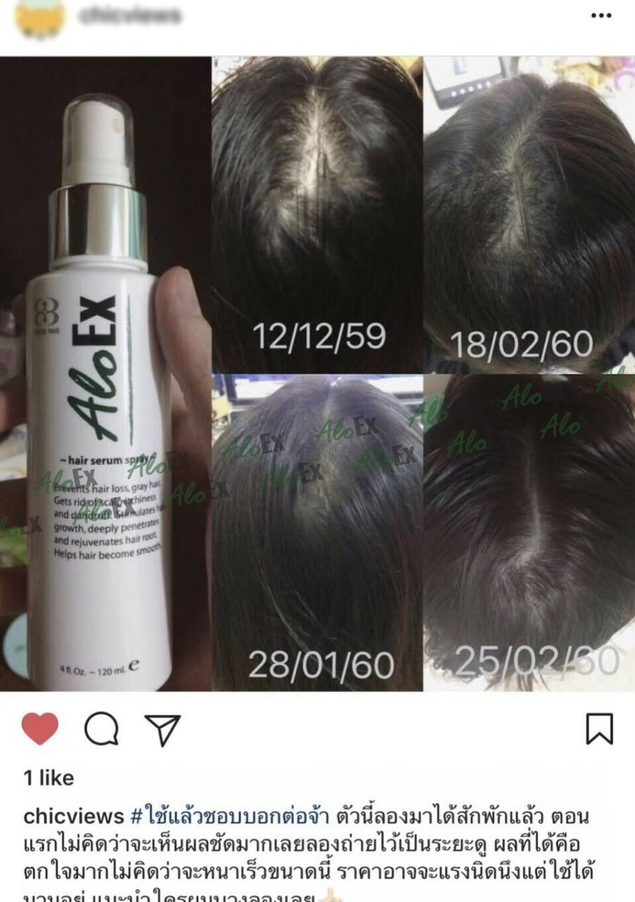 AloEx 3 Steps Original Set Gift Set เซตดูแลหนังศีรษะ Set A Original Shampoo + Hair Mask ...