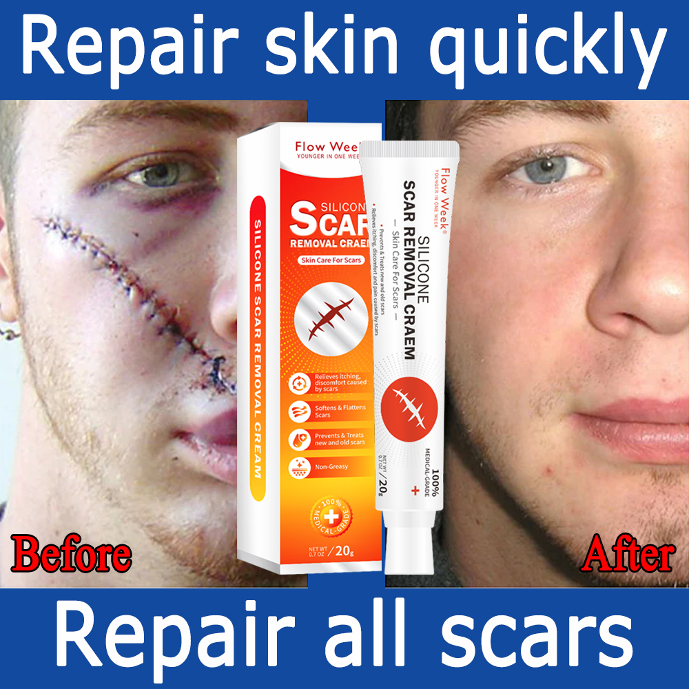 FlowWeek Scar Cream Sigh Scar Repair Scar Old Scar Blisters Bleeding ...