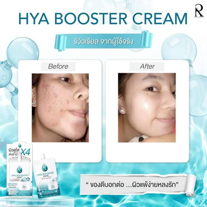 Ratcha Hya Booster Serum เซรั่มไฮยา บูสเตอร์ By น้องฉัตร 15ml.+ Hya ...