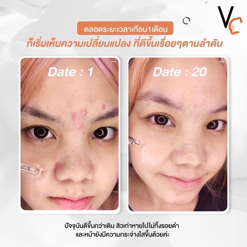 พร้อมส่ง วิตซี น้องฉัตร VIC C Bio Face Serum 10g - Beautyqueen69 - ThaiPick