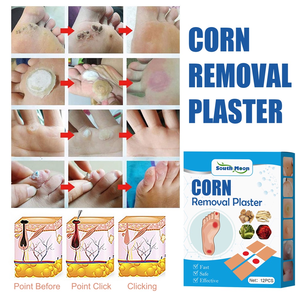 12แผ่นกล่อง Corn Wart Remover Plaster Canopy Patch Plaster Corn Removal ...