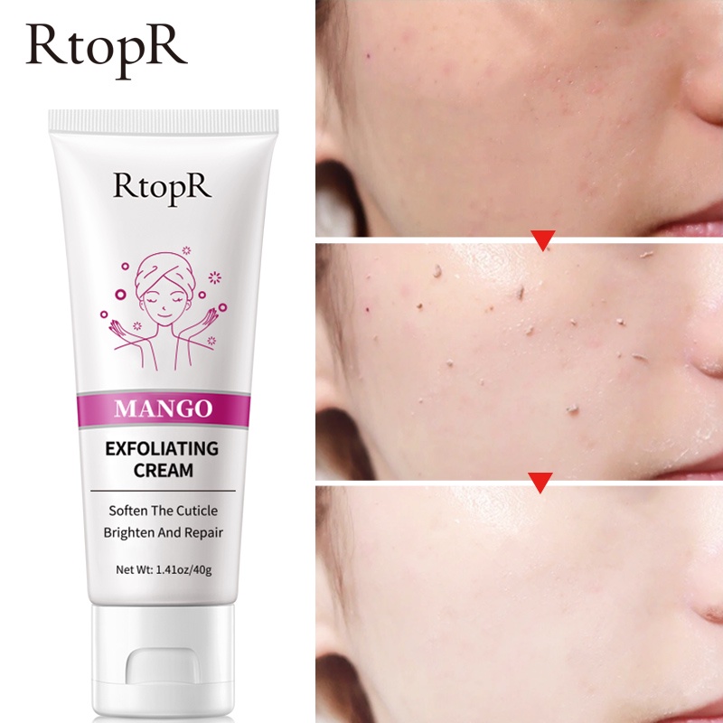 RtopR Facial Exfoliating Cream เจลมะม่วงขัดผิว ฮิตใน Tiktok RtopR Mango ...