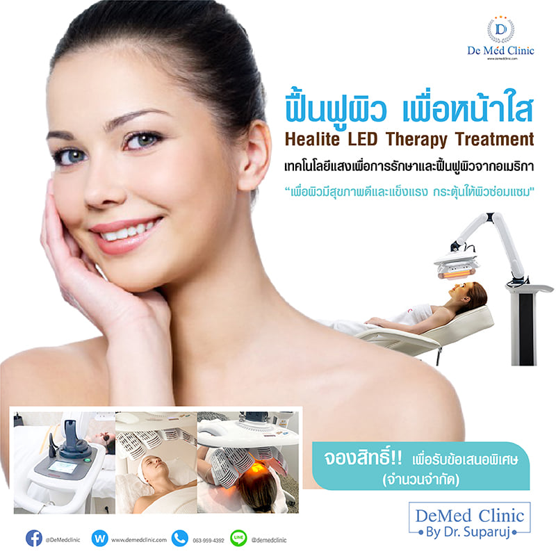 บรรเทาผื่น ผิวหนังอักเสบ Seb Derm ด้วย Sebclair CreamSebclair Cream 30 ...