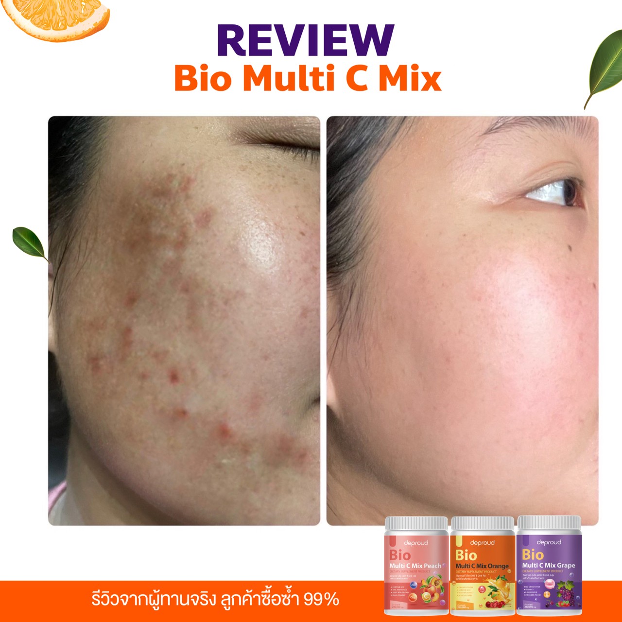 ส่งฟรี!! 🍑🍊🍇Deproud Bio Multi C Mix วิตามินซีสด วิตามินซีถัง ไบโอวิตซี ...