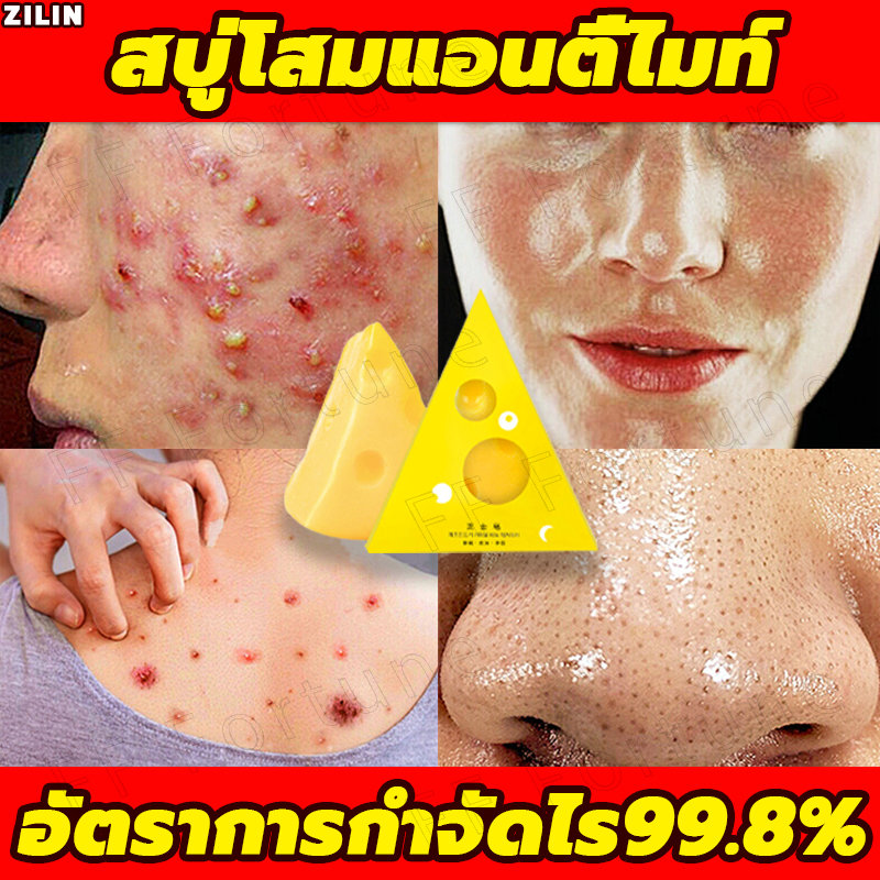 [แจกตาข่ายตีฟอง]ZiLin สบู่ผิวขาว อุดมด้วยสารสกัดจากโสม มความมันและกำจัด ...