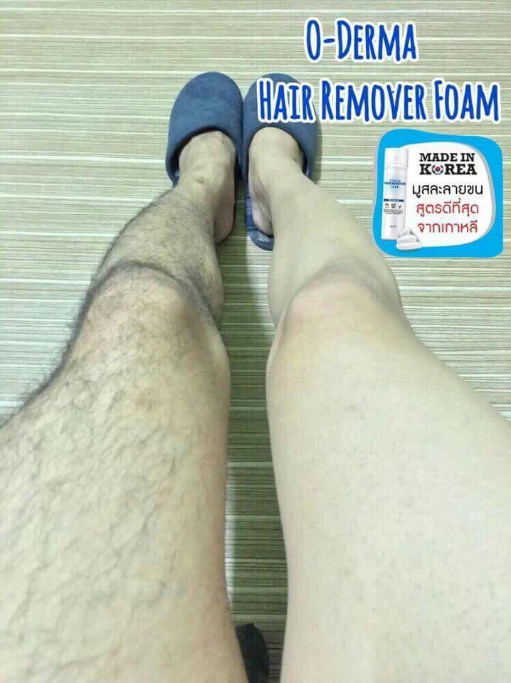 โอเดอร์มา แฮร์ รีมูฟเวอร์ โฟม O-Derma Hair Remover Foam (120ml) (X10) - Tongnoi Shop - ThaiPick