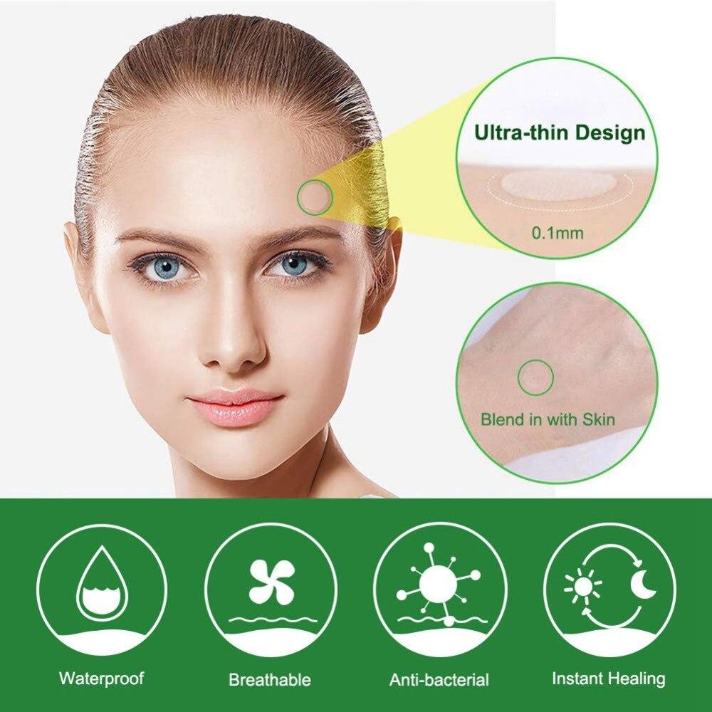 (แท้) Tea Tree Acne Pimple Patch Hydrocolloid Waterproof Clear Pimple ...
