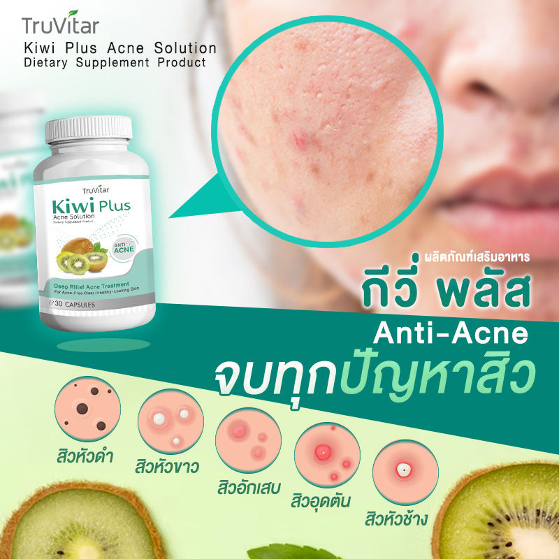 พร้อมส่ง ฟรี TRUVITAR Kiwi Plus Acne Solution ผลิตภัณฑ์เสริมอาหารสารสกัดจากกีวี่ สำหรับผู้ที่มี ...