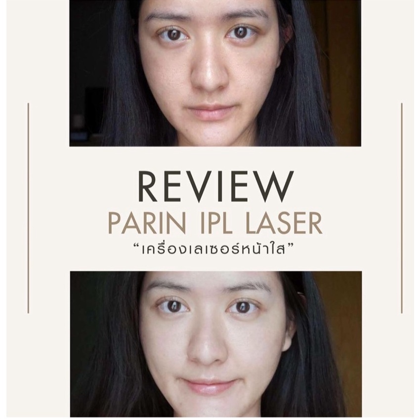 PARIN IPL LASER: หัวยิงเลเซอร์ กำจัดขน / หน้าใส (ใส่ได้เฉพาะตัวเครื่อง ...