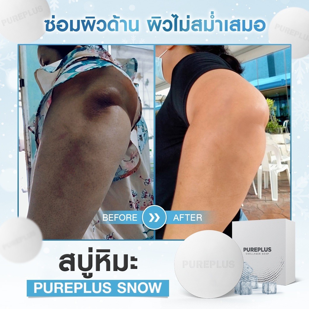 PUREPLUS Coollagen Snow : สบู่หิมะ ลดสิว ผิวเด้ง ขาวใส 3 ก้อน 500.- ส่งฟรี - Pureplus Thailand ...