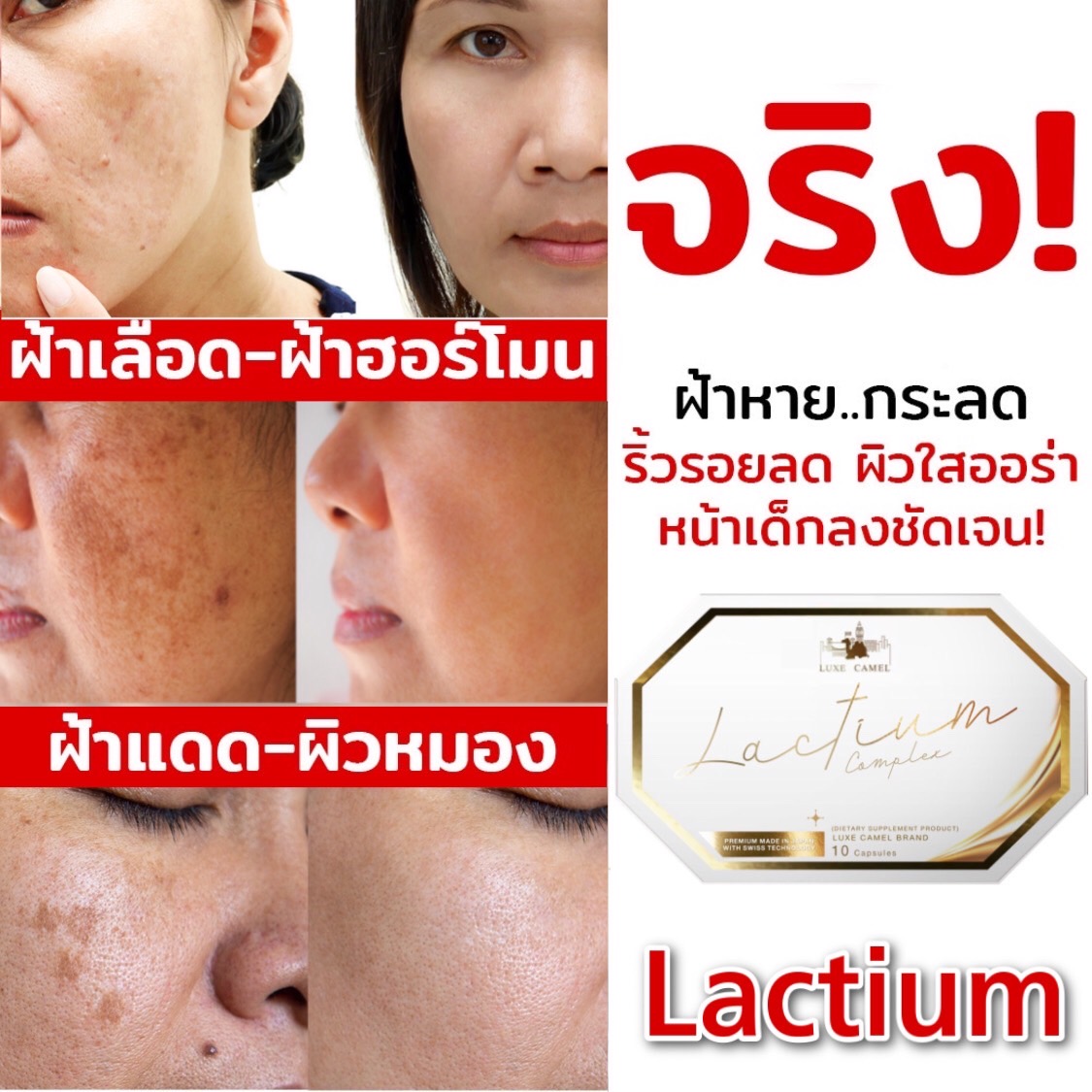Lactium Complex วิตามินนมอูฐลดฝ้า จุดด่างดำและ สิว ช่วยให้หน้ากระจ่างใส ...