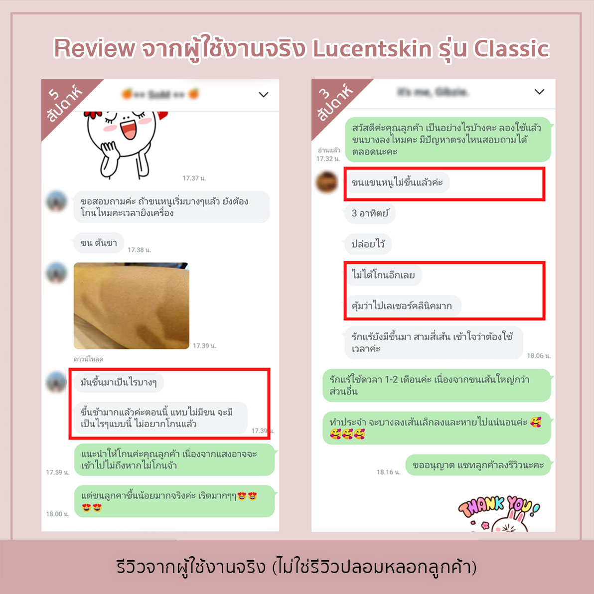เครื่องเลเซอร์ IPL รับประกัน 1 ปี Lucentskin เครื่องไอพีแอล เครื่องกำจัดขนถาวร เลเซอร์หน้าใส ...