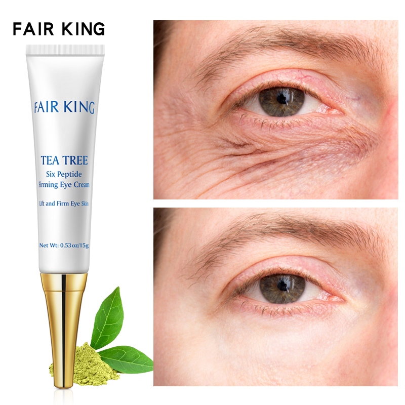 FAIR KING Anti Wrinkle Eye Cream Removes Dark Circles Eye Bags ...