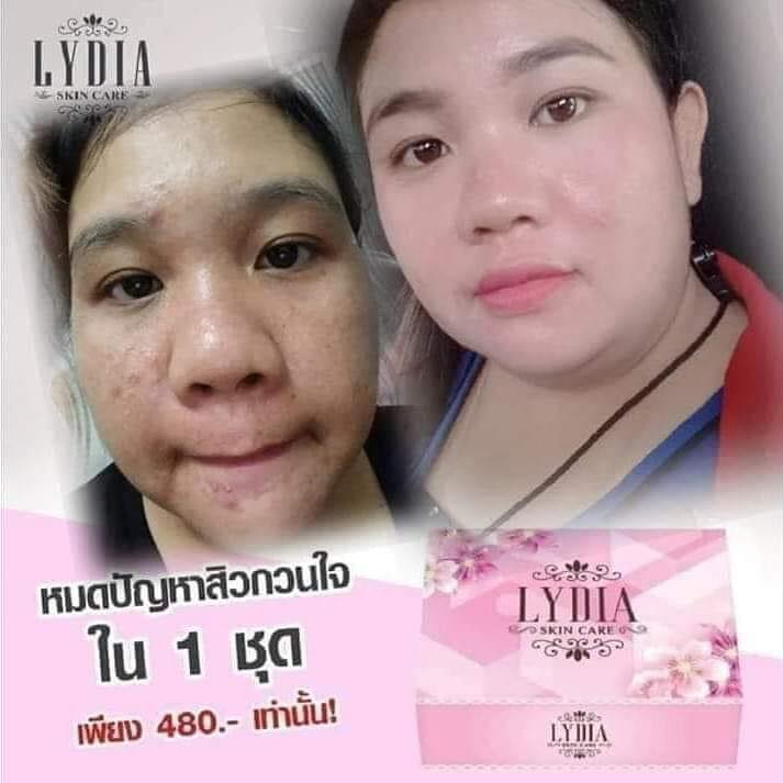 Lydia Cream ครีมลิเดีย ครีมบำรุงผิวหน้า ชุดครีมลิเดีย ขนาด5g.(1เซต ...