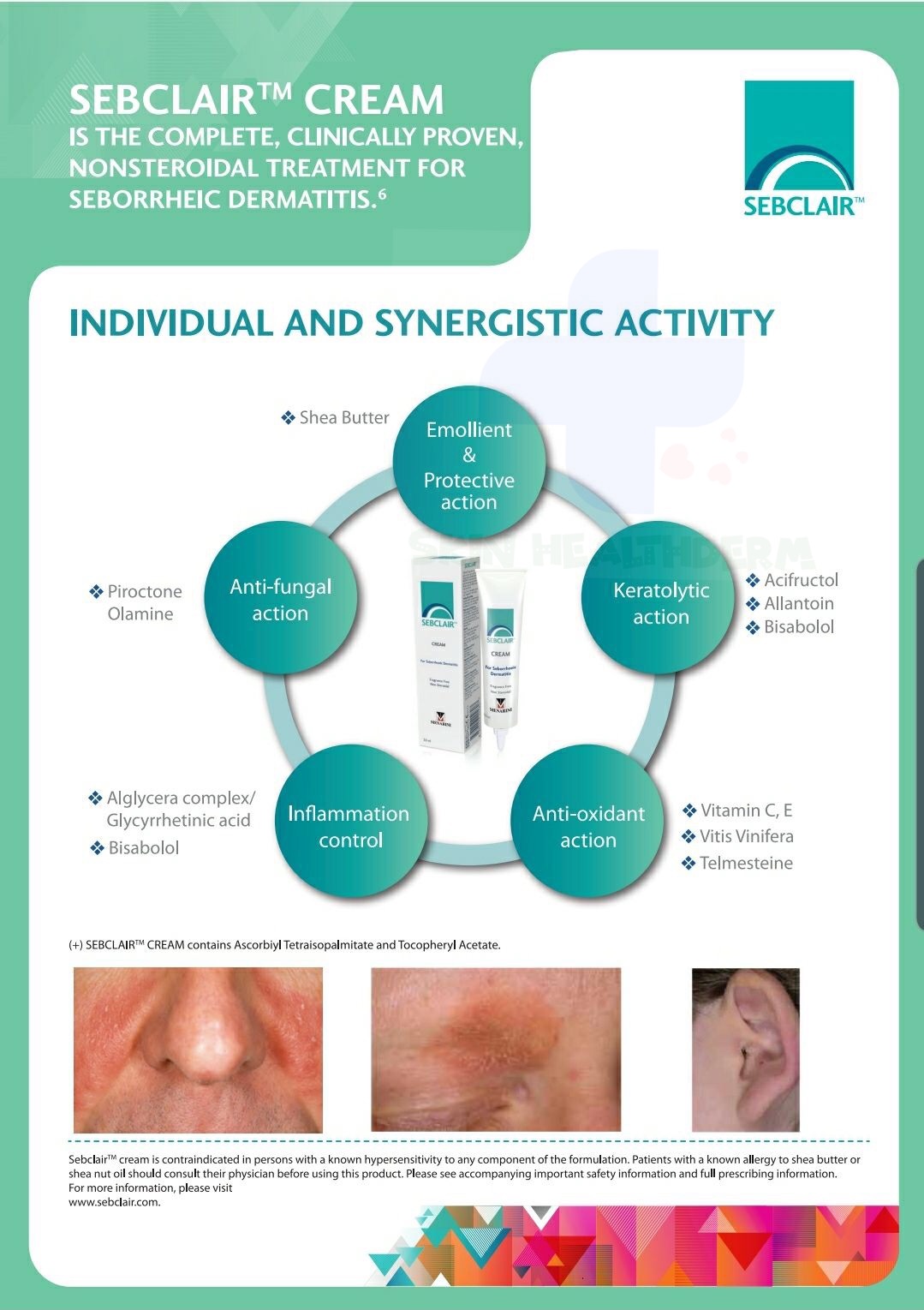 ราคาถูกSaleของแท้100 Sebclair cream เซ็บแคร์ ครีมครีมรักษาเซ็บเดิร์ม ...