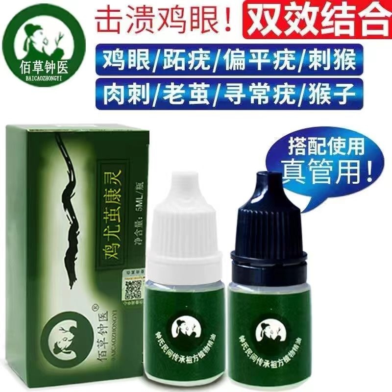 Corn ointment paste thorn monkey meat plantar wart special to remove ...