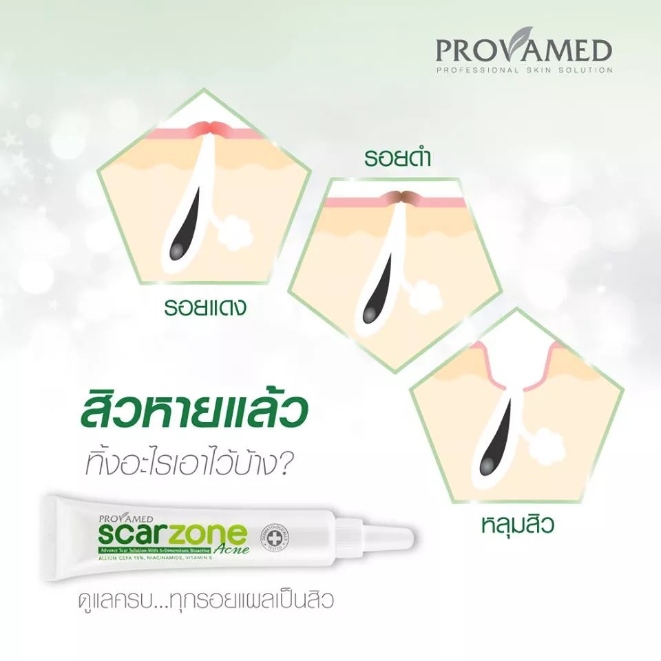 Provamed Scarzone Acne 10 G โปรวาเมด สการ์โซน แอคเน่ เลิกนอยด์เรื่องรอย ...