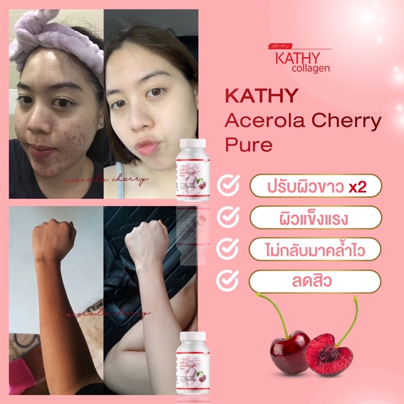 1 แถม 1 กระปุก️ Collagen Kathy Acelora Cherry Pure วิตามินซีสูง คอลลาเจนคาตี้ ลดสิว ผิวขาวไว ...