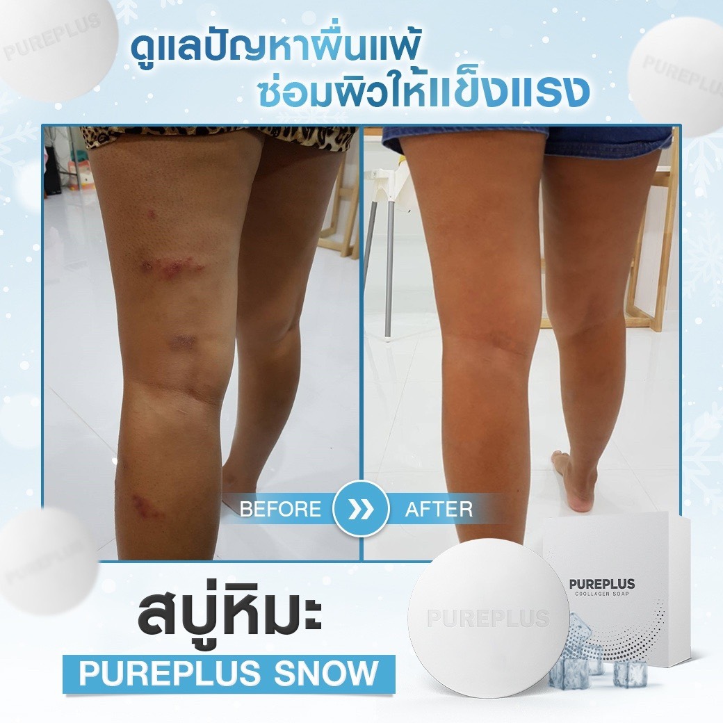 PUREPLUS Coollagen Snow : สบู่หิมะ ลดสิว ผิวเด้ง ขาวใส 3 ก้อน 500.- ส่งฟรี - Pureplus Thailand ...