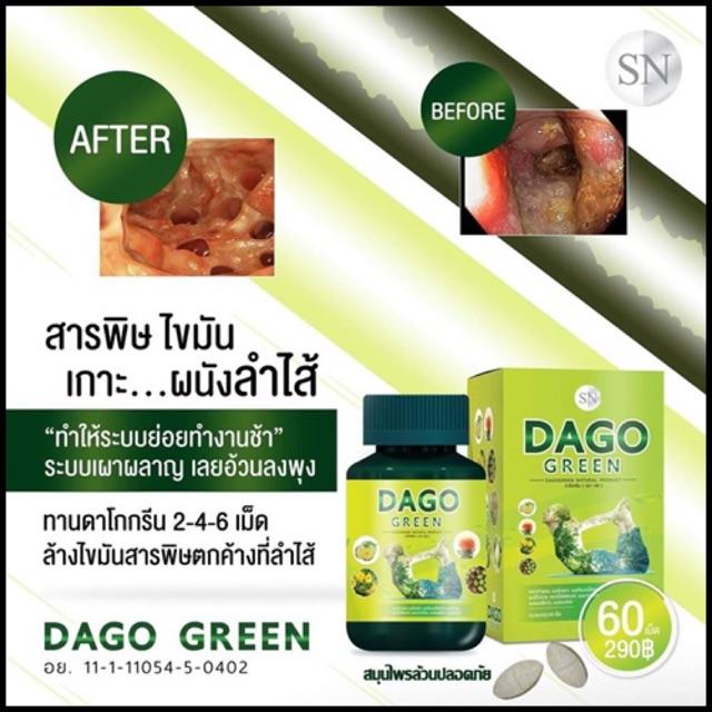 ของแท้ Dago Green 70 เม็ด สูตรใหม่ Dakota Detox ดาโกกรีน ดาโกต้า ดีท็อก ...