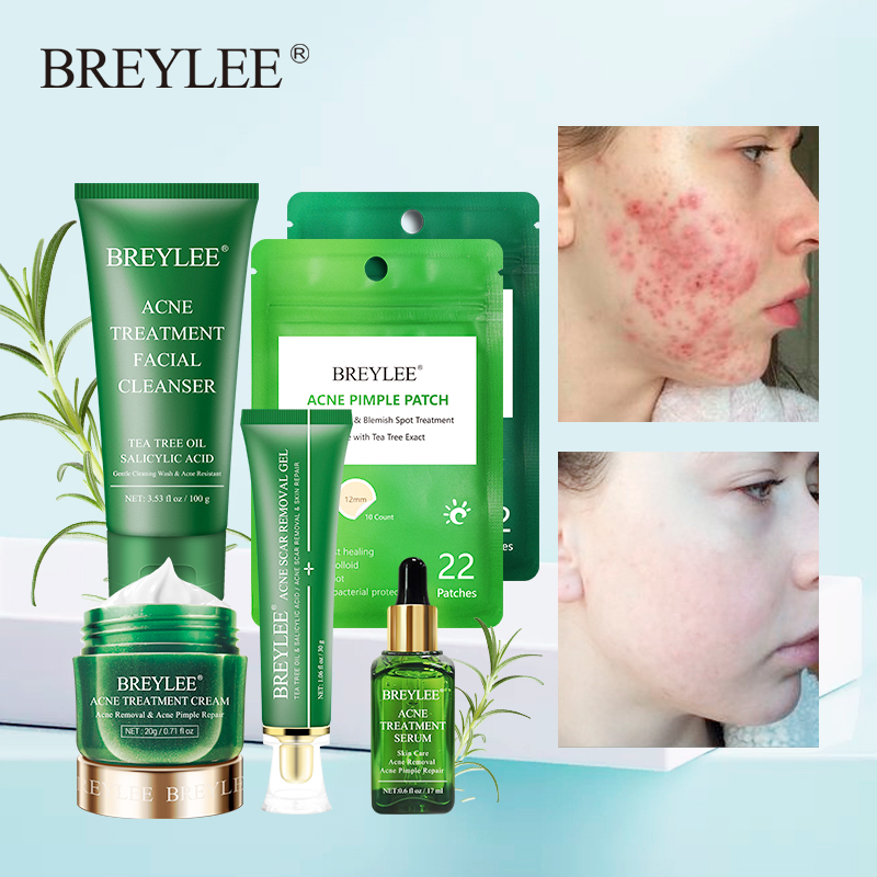 BREYLEE แผ่นแปะสิว สำหรับกลางวัน (22 แพทช์) ACNE PIMPLE PATCH - Golden ...
