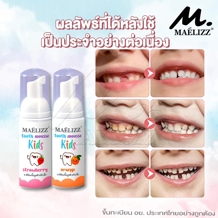 NEW 8 ขวด มูสแปรงฟันสำหรับเด็ก Maelizz Tooth Mousse Kids ปริมาณ 60ml. ป้องกันฟันผุ น้ำยาบ้วนปาก ...