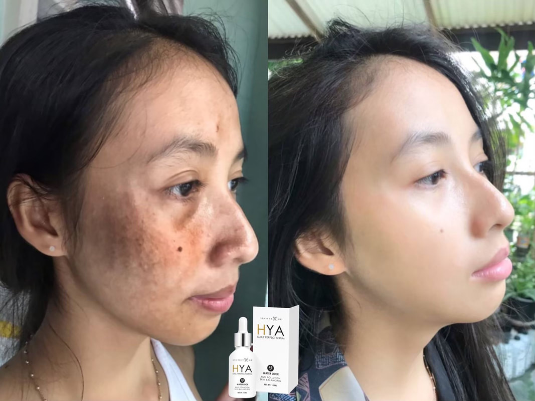 HYA Daily Perfect Serum SECRET ME - Aqlz - ThaiPick