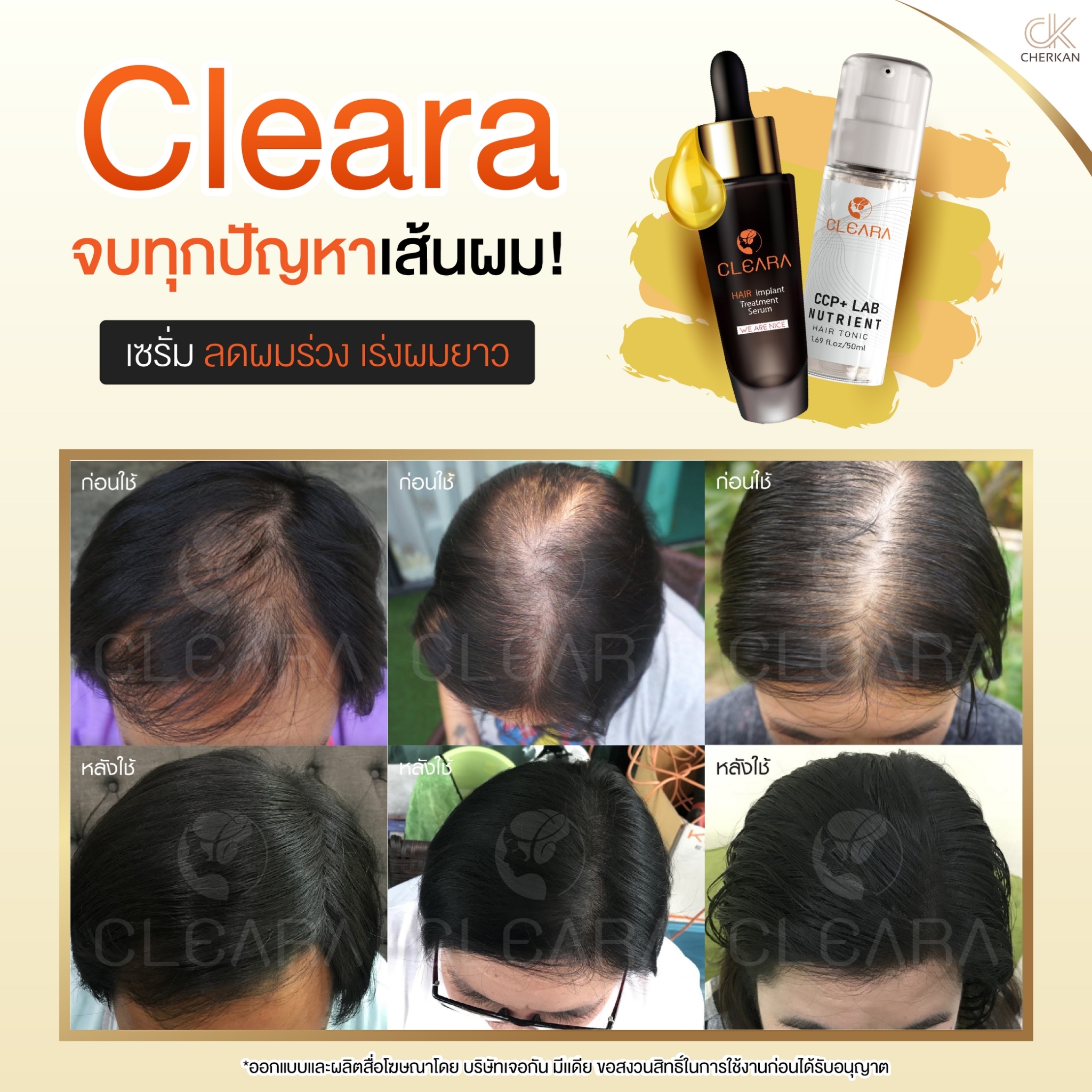 (โปรคู่ 2แถม1) เคลียร่า เซรั่มปลูกผม + เคลียร์ร่า แฮร์ โทนิค (CLEARA HAIR TONIC) สเปรย์บำรุงราก ...