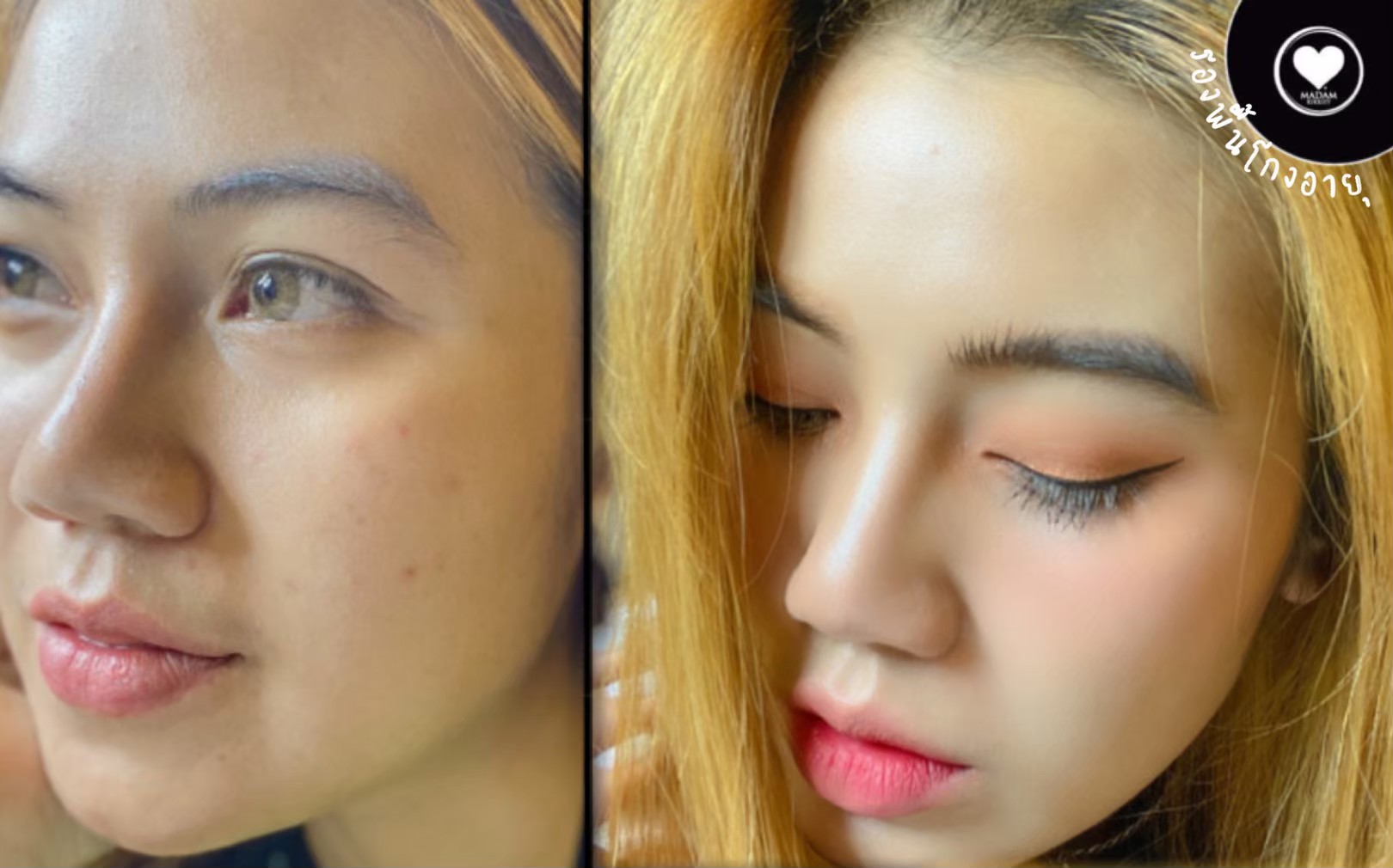 Derma UV Foundation WhipCream รองพื้นผสมกันแดด SPF25 PA++ สำหรับคนเป็น ...