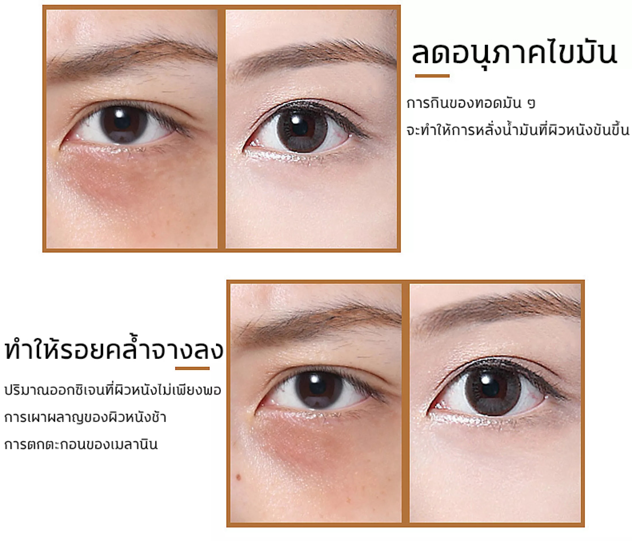 CYCY ครีมแก้ขอบตาดำ 30ml กำจัดขอบตาดำ ครีมทาตาดีๆที่ใครๆก็ใช ครีมบำรุง ...