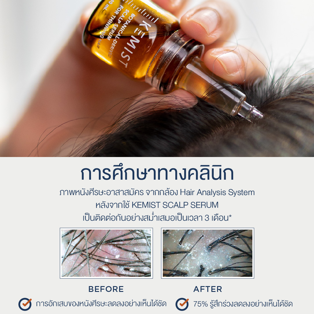 KEMIST | เซรั่มบำรุงหนังศีรษะเพื่อเส้นผมที่หนาขึ้น - Kemist Labs - ThaiPick