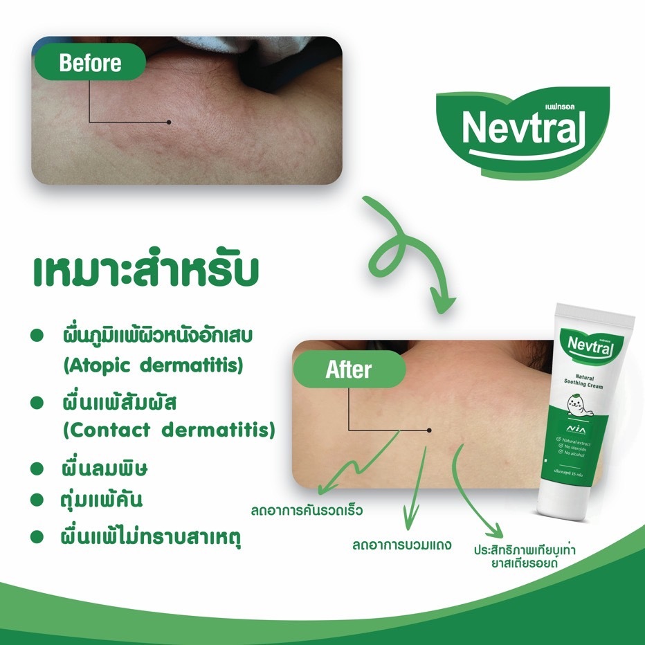 Nevtral Natural Soothing cream 15g เนฟทรอล เนเชอรัล ซูทติ้ง ครีม ทาแก้ ...