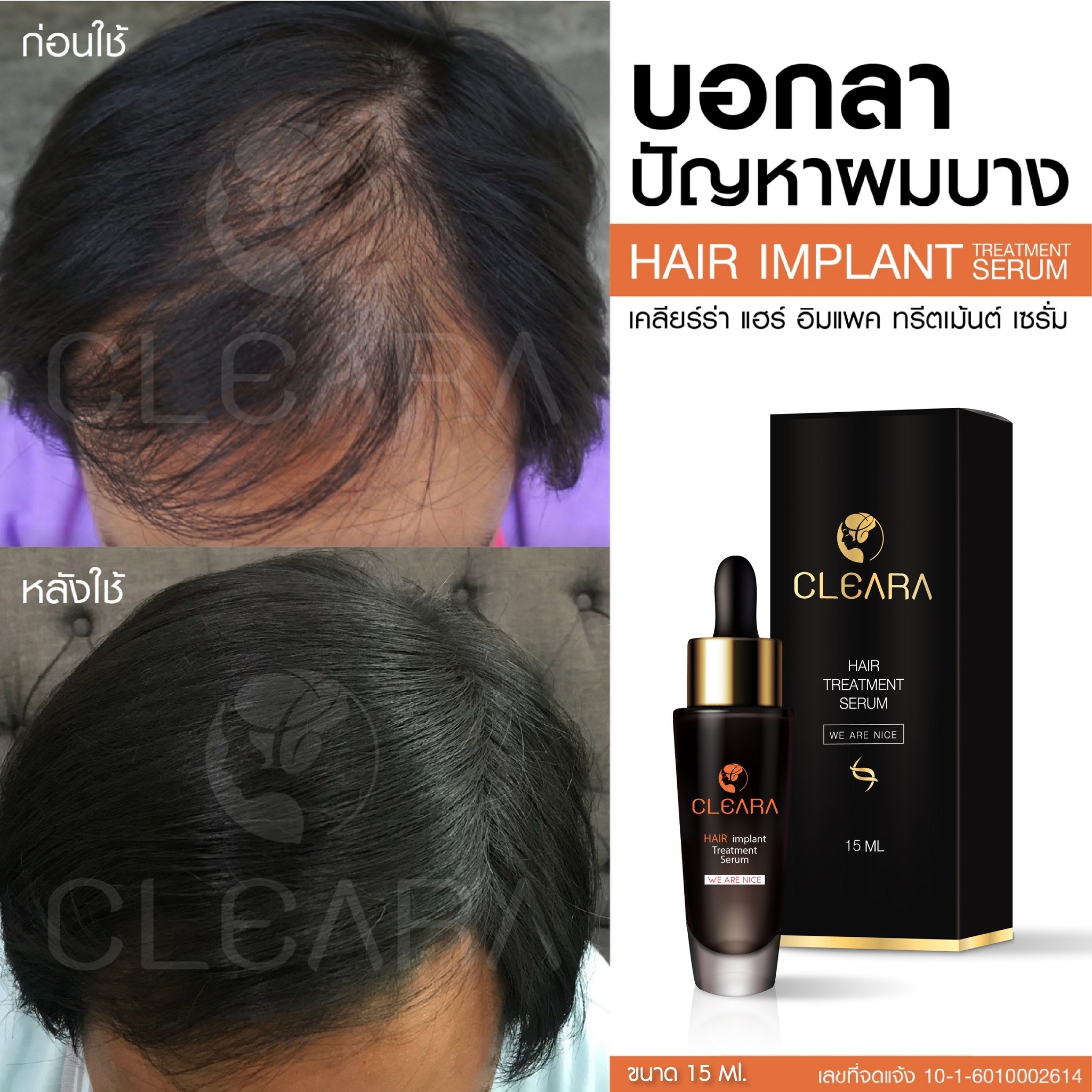 Cleara เคลียร่า เซรั่มปลูกผม กระตุ้นรากผม ลดการหลุดร่วง ขนาด 15 ml. (1 ขวด) 290บาท ส่งฟรี - รวย ...