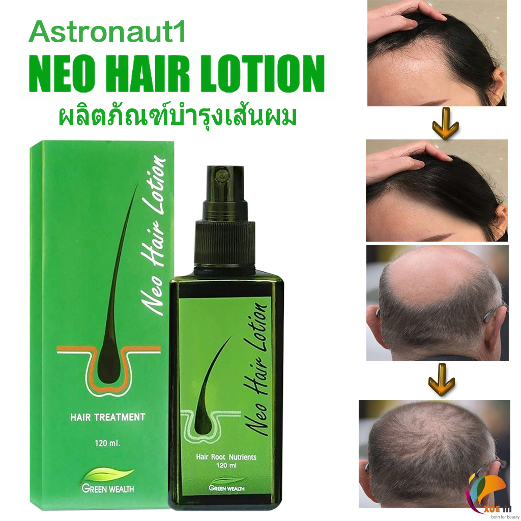 【จัดส่งทันที】นีโอ แฮร์ โลชั่น Neo Hair Lotion (1 ขวด บรรจุ 120 ml ...