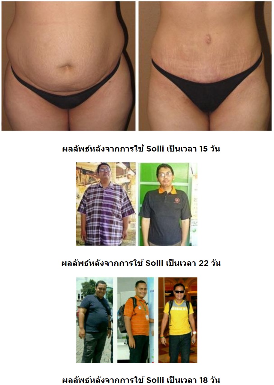 ☘️ SOLLI ผลิตภัณฑ์อาหารเสริมลดน้ำหนักจากธรรมชาติ (( 6 กล่องราคาพิเศษ + 3 SOLLI FREE ...