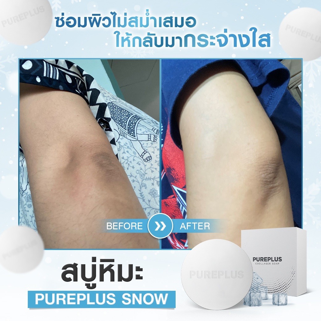 PUREPLUS Coollagen Snow : สบู่หิมะ ลดสิว ผิวเด้ง ขาวใส 3 ก้อน 500.- ส่งฟรี - Pureplus Thailand ...