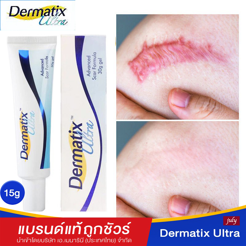 Dermatix Ultra 15g เดอร์มาติกซ์ ครีมลบแผลเป็น เจลซ่อมแซม เจลลบรอย ...
