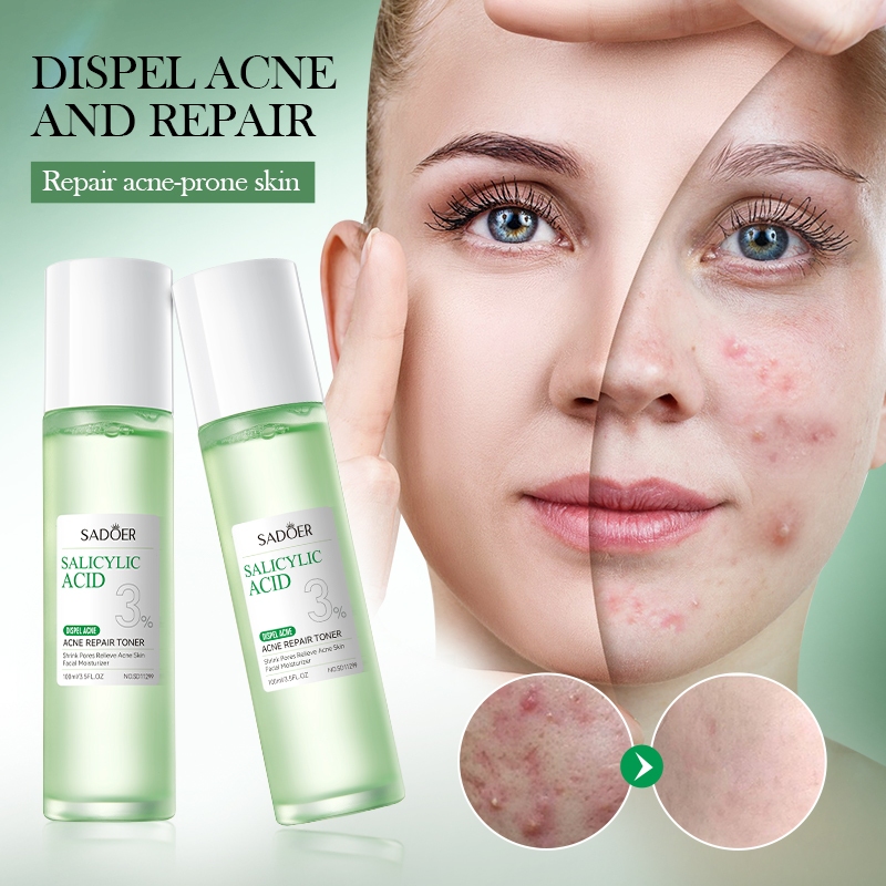 SADOER 3 กรด Salicylic โทนเนอร์และโลชั่นขจัดสิว ลดรอยแผลเป็นจากสิว โลชั่นกำจัดสิวแห้งเหมาะสำหรับ ...