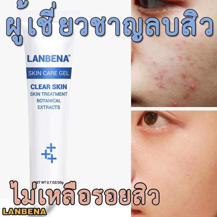 MEMONY SKINCARE APPLE WHITENING ACNE NIGHTCREAM ครีมแอปเปิ้ลหน้าใส ครีม ...